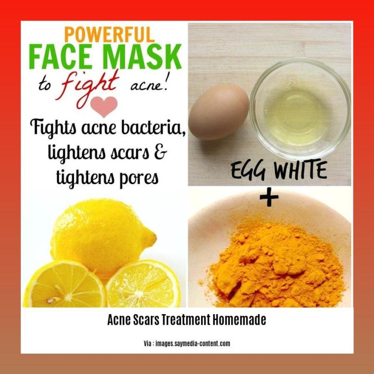- Acne Scars Treatment Homemade: Natural Remedies and DIY Solutions for ...