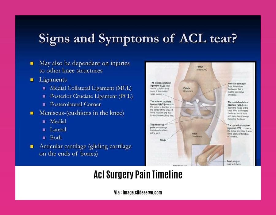 Navigating The ACL Surgery Pain Timeline Expert Guidance For Optimal Navigating The ACL Surgery Pain Timeline Expert Guidance For Optimal