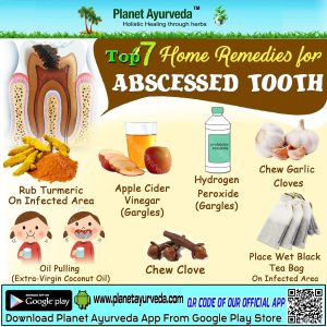 The Best Home Remedy for Abscess Tooth Pain: Find Relief Today - Wave Sold