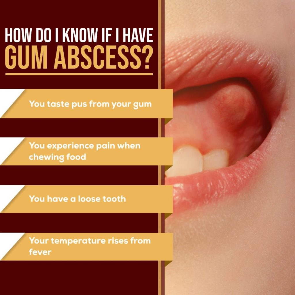 Home Remedies for Cut in Mouth: Comprehensive Guide for Natural Healing ...