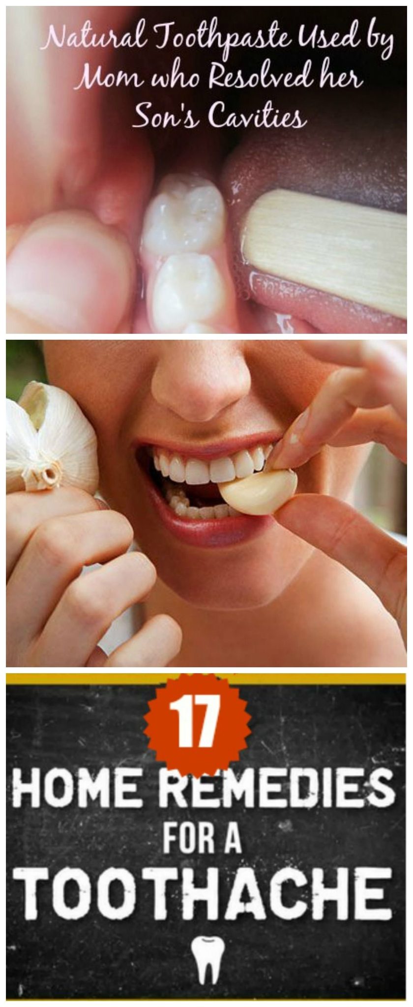 Home Remedies for Gum Pain Caused by Wisdom Tooth Eruption - Wave Sold